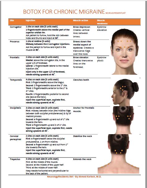 Botox Injections Artofit