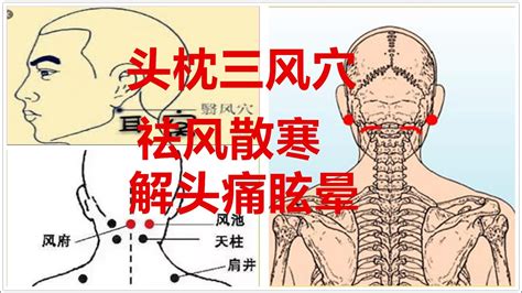 Massage for headache and dizziness acupoints for headache 头枕部三风穴轻松缓解