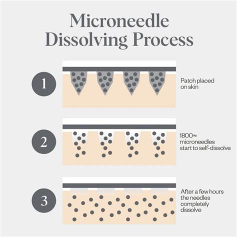 Self Dissolving Microneedle Patches 8 Patches 4 Pair Prischmann Skin