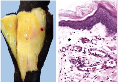 Inflammation And Tissue Repair Pictures Flashcards Quizlet