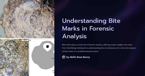 Understanding Bite Marks In Forensic Analysis