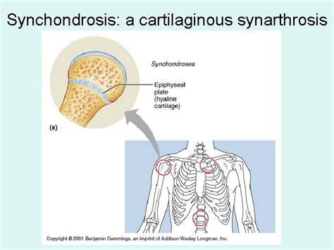 Articulations Chapter 8 Structural Classification Of Joints Fibrous