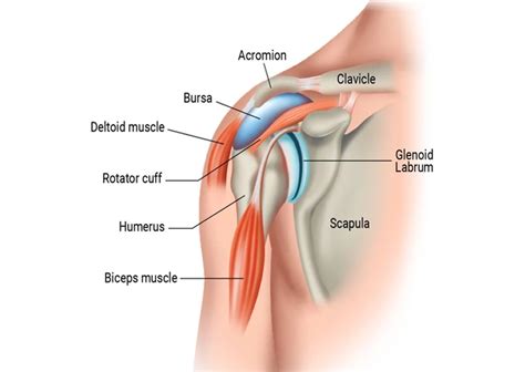 Non Surgical Labrum Tear Treatment For Shoulder Orthorenew