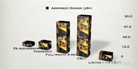 Cbct