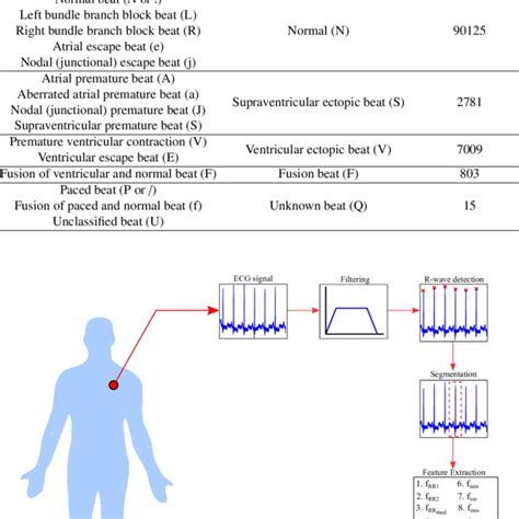 Pdf Arrhythmia Classification From Single Lead Ecg Signals Using The