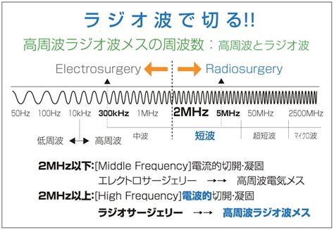SALE71 OFF 電気メス 高周波ラジオ波メス ジャンク扱 asakusa sub jp