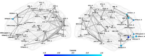 Regions With Significant Differences In Nodal Efficiency Between AD Download Scientific Diagram