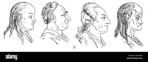 Medicine Anatomy Physiognomy Four Temperaments Fltr Phlegmatic