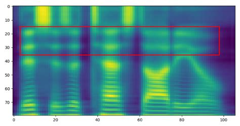 Speaker Characteristics Guided Speech Synthesis