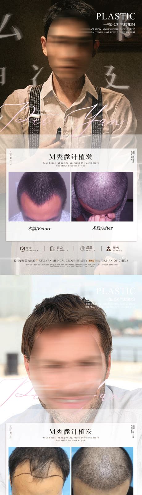 医美项目案例对比psd广告设计素材海报模板免费下载 享设计