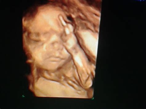 Ecografía De Ainara Con 26 Semanas De Gestación 🤰🏻 Etapas Del
