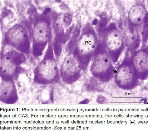 Photomicrograph Showing Pyramidal Cells In Pyramidal Cell Layer Of Ca3