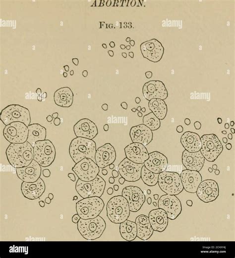 A Manual Of Clinical Diagnosis By Means Of Microscopical And Chemical Methods For Babes