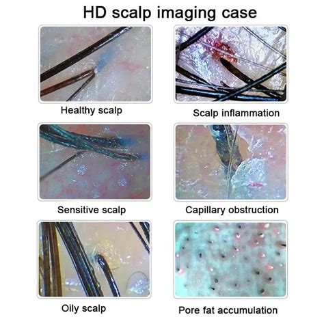 Professional Digital Scalp Analyzer