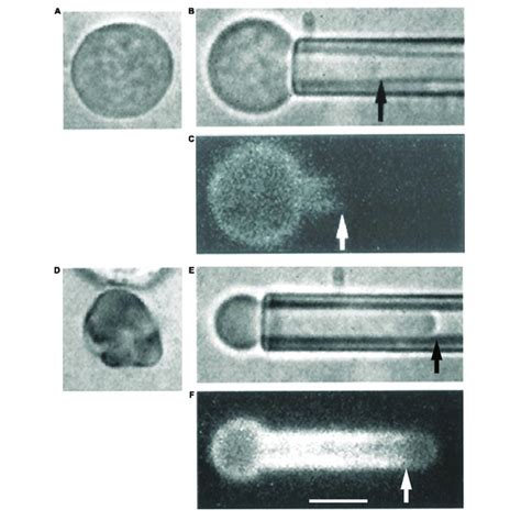 Erythroid Cells From Adult Human Marrow Also Exhibit The Formation Of