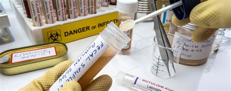 Examen De Sangre Oculta En Heces En Panam America Lab