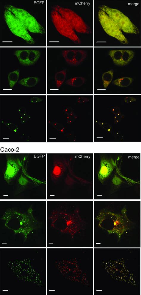 The Localization Pattern Of Mcherry Egfp Cg Tagged Sqstm1 In Caco 2