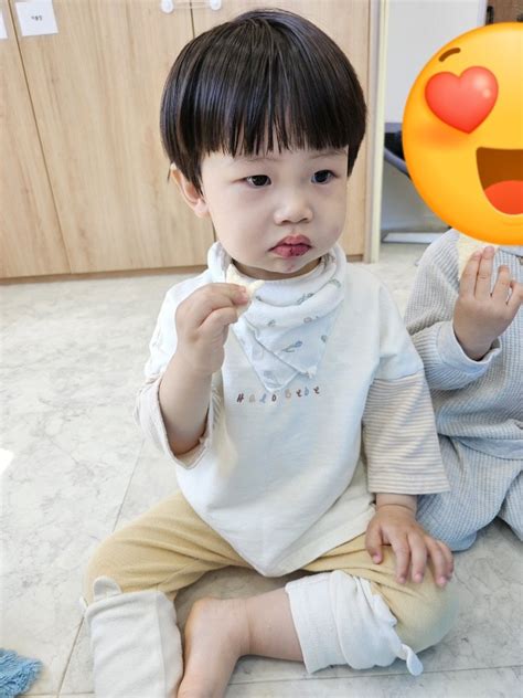 아기 입술 찢어짐 흉터 재생치료 및 관리방법 네이버 블로그