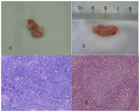 Dissected Deep Neck Lymph Nodes Of A Rabbit B Measurement Of The Long