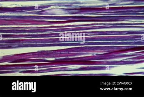 Striated Muscles Of The Body At High Magnification Under The Microscope
