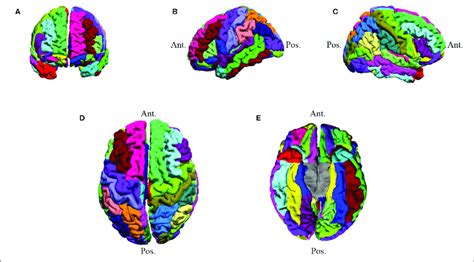 Subject Dt007 Brainsuite Processed Mr Image The Image Underwent Download Scientific Diagram
