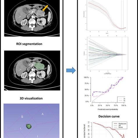 Sketch Map Of Texture Parameter Extraction Of Pancreatic Tumor Ct Image Download Scientific