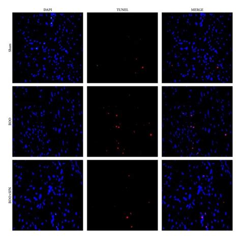 Effect Of Sfn On Cell Apoptosis And Proliferation In Boo Rats A Download Scientific Diagram
