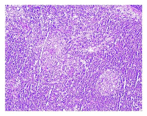 Lymph Node Showing Reactive Germinal Centers And Expanded Paracortical Download Scientific