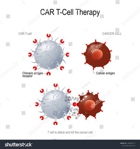 Car T 면역요법인공 T세포 수용기는 암치료암세포 스톡 일러스트 1360006175 Shutterstock