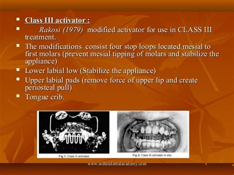 Early Correction Of Angles Class 3 Malocclusion