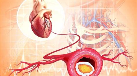 Oct 9447 Ectatic Ascending Aorta Key Size Criteria Normal Ranges And