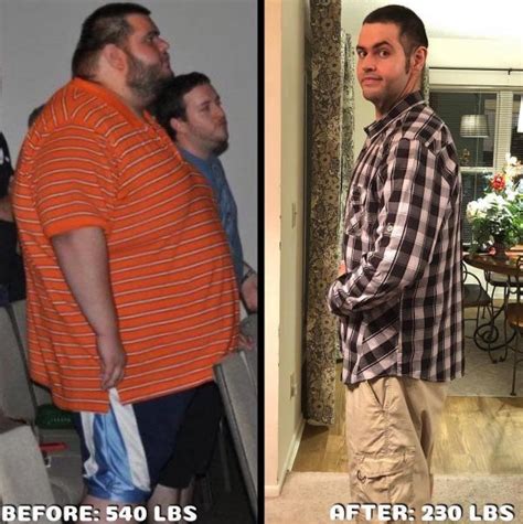 Joven Obeso Pierde Libras En Meses Antes De Casarse Con Su Novia De La Escuela Obesidad