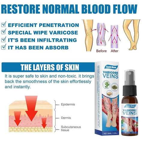 South Moon Varicose Vein Spray Givemethisnow