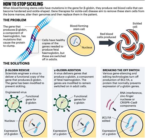 The Toughest Test Yet For Gene Therapy Sickle Cell Disease Affecting