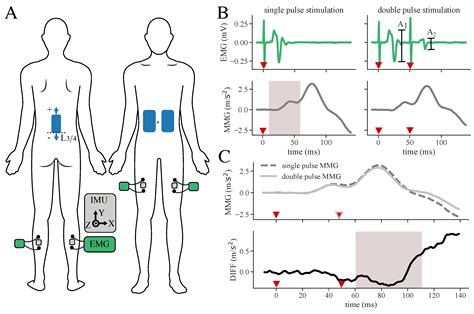 Targeting Transcutaneous Spinal Cord Stimulation Using A Supervised Machine Learning Approach