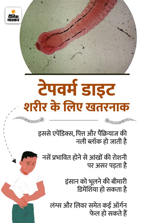 Tapeworm Diet Side Effects Us Maria Callas Tapeworm Diet Mystery