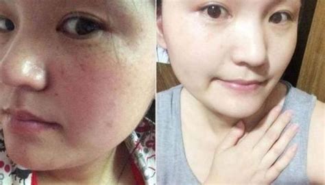 牛奶加『它』，7天美白淡斑，15天皮膚光滑細嫩 每日頭條