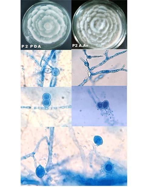 Can Anyone Help Me Identify These Phytophthora ResearchGate