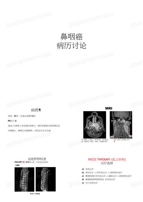 鼻咽癌病历讨论ppt模板下载 编号lapzovpn 熊猫办公