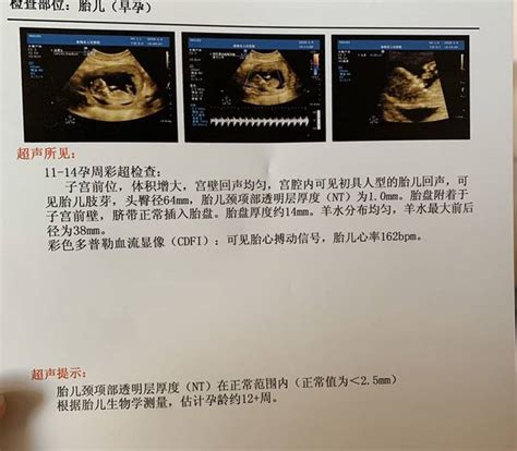 12周nt值对照表 千图网
