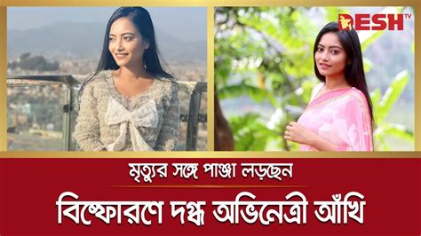 মৃ ত্যুর সঙ্গে পাঞ্জা লড়ছেন বিষ্ফো রণে দ গ্ধ অভিনেত্রী আঁখি Akhee