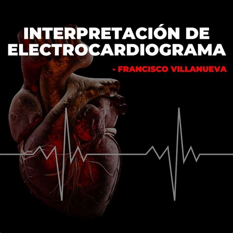 Interpretación de Electrocardiograma EKG NURSE EDUCATION Hotmart