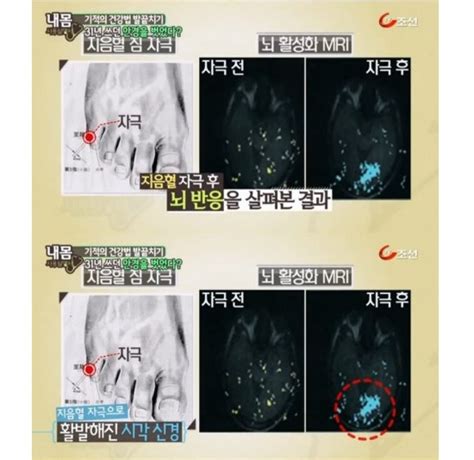 골다공증 무릎관절 좋은운동 발끝치기 운동법