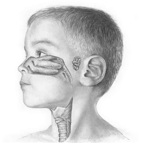 Pediatric Ent Denta Danish Ent Academy