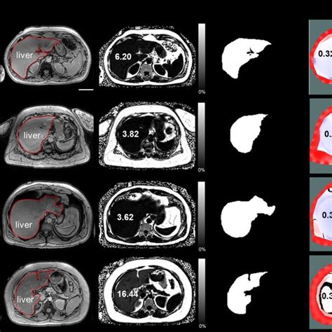Representative Mri Multi Echo And Eit Images Four Representative