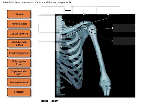 Solved Label The Bony Structures Of The Shoulder And Upper Limb Label The Bony Structures Of