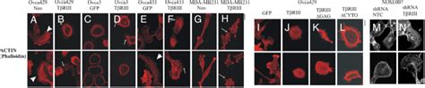 Triii Alters The Actin Cytoskeletal Organization Of Epithelial And