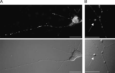Accumulation Of Span Staining Within Toxin Induced Membrane