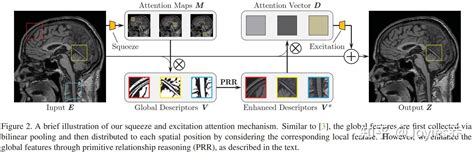 Cvpr2021 医学重建及医学分割论文汇总 知乎