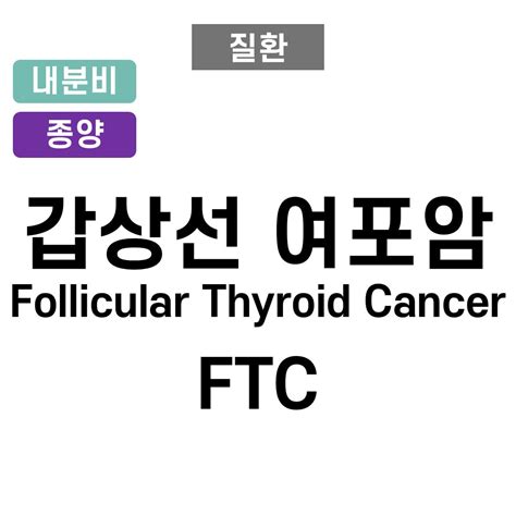 갑상선 여포암 Follicular Thyroid Cancer 의학당